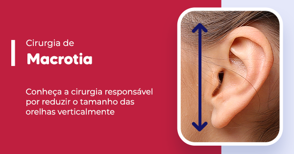 Macrotia - Projeto Orelhinha